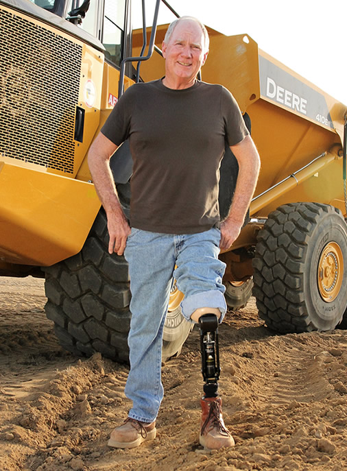 Prosthetics | R & J Prosthetic